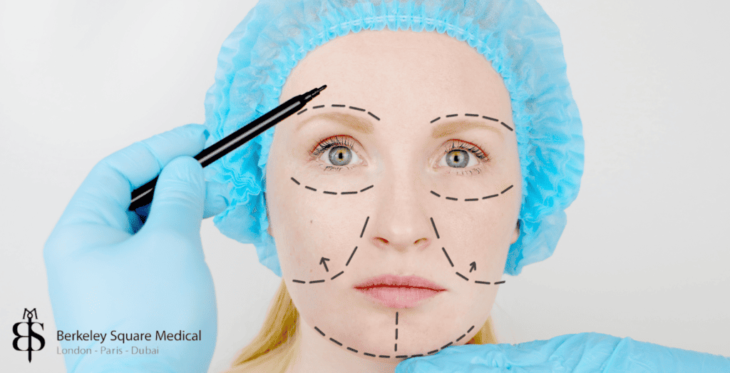 planning a face lift procedure - Berkeley Square Medical - Central London